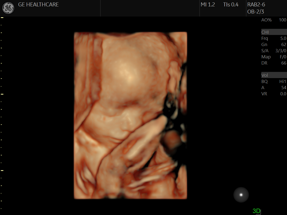 LOGIQ P7 - Ocean Med