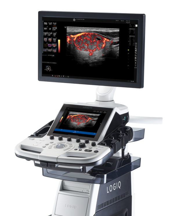 LOGIQ P7 - Ocean Med